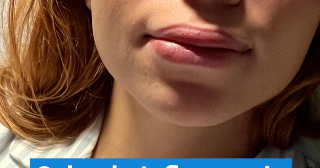 Schock: Influencerin Nicolette Fountaris erleidet Schlaganfall mit 36 ...