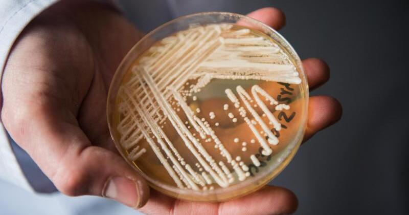 Mehr Patienten mit gefährlichem Hefepilz | GMX.CH